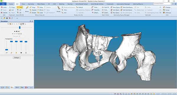 Alphacam “vital” for orthopaedic implant expert – MTI Magazine